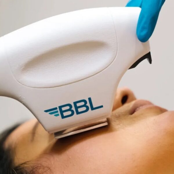 BBL Forever Bare Laser Hair Removal Louisville CO